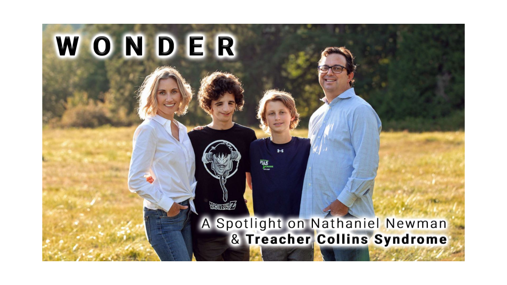Disability Spotlight: Nathaniel Newman, Treacher Collins, & "Wonder ...